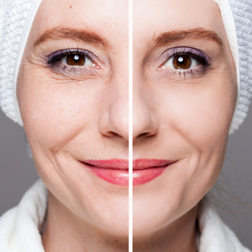 6 Benefits of Microneedling for Achieving Glowing Skin ...