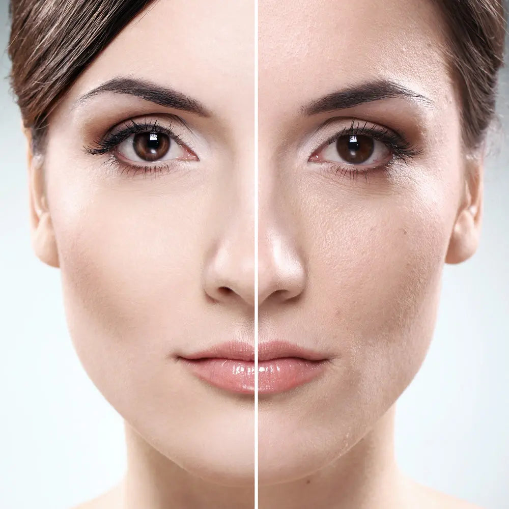 DermaCell Collagen Cream | Derma Roller System® – DermaRollerSystem.com